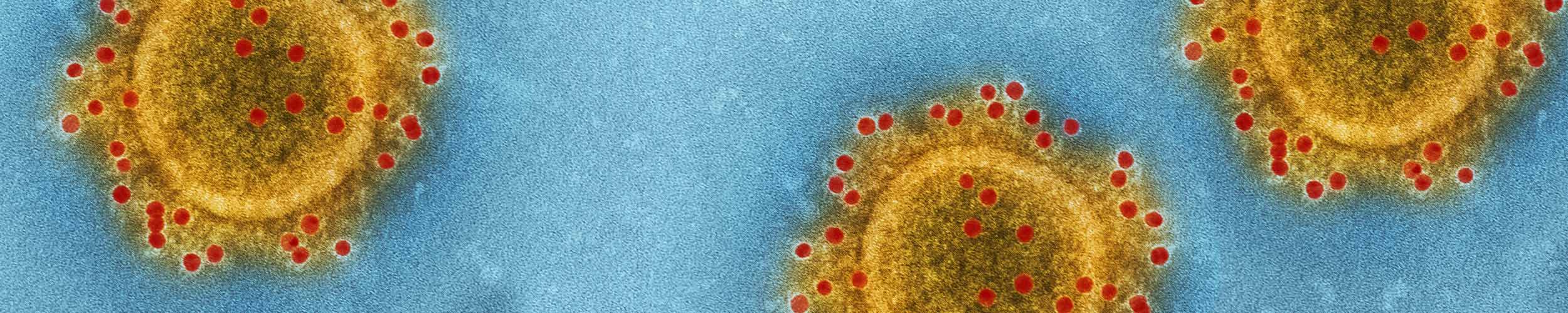 Métaprogramme XRisques - Perception & comportements